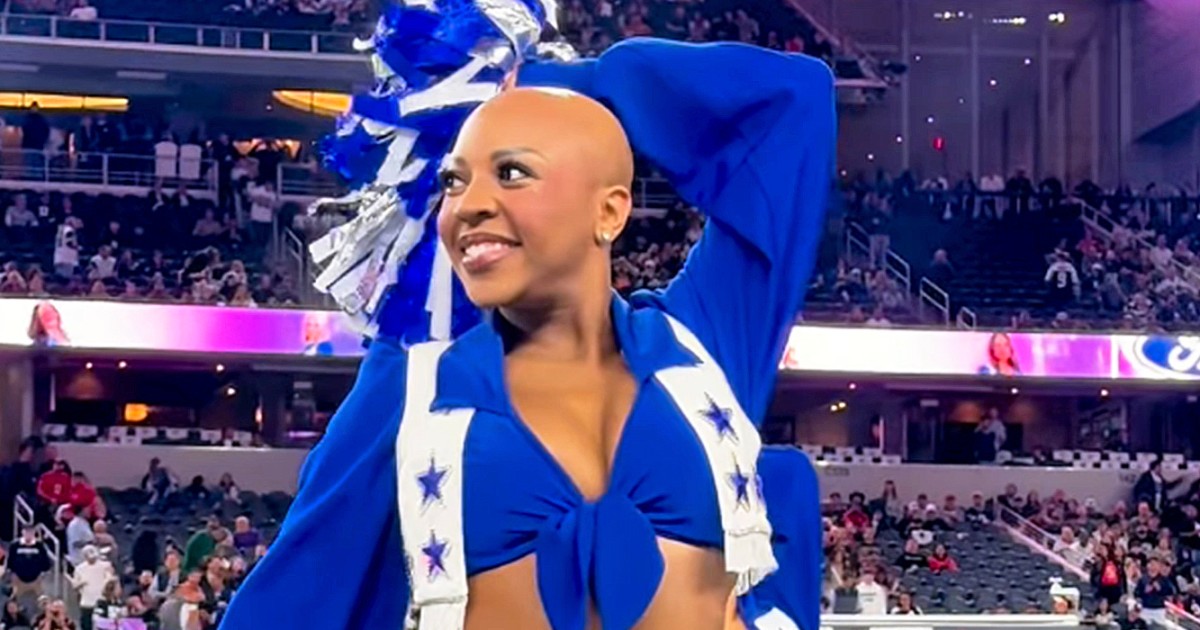 Dallas Cowboys Cheerleader with Alopecia Performs Without Wig in Now ...