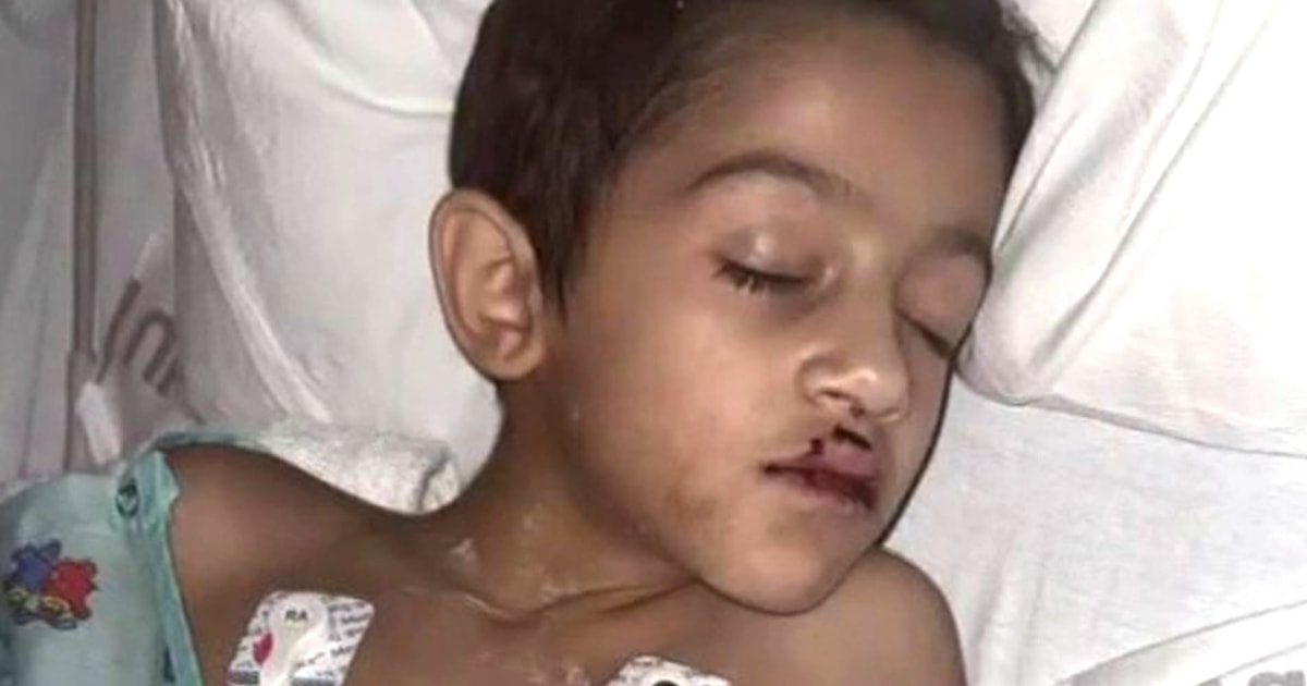 Boy, 7, Injured By Falling Drone, Needs Emergency Heart Surgery