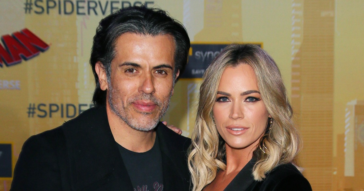 Teddi Mellencamp’s Estranged Husband Gives Update After Brain Tumor Surgery