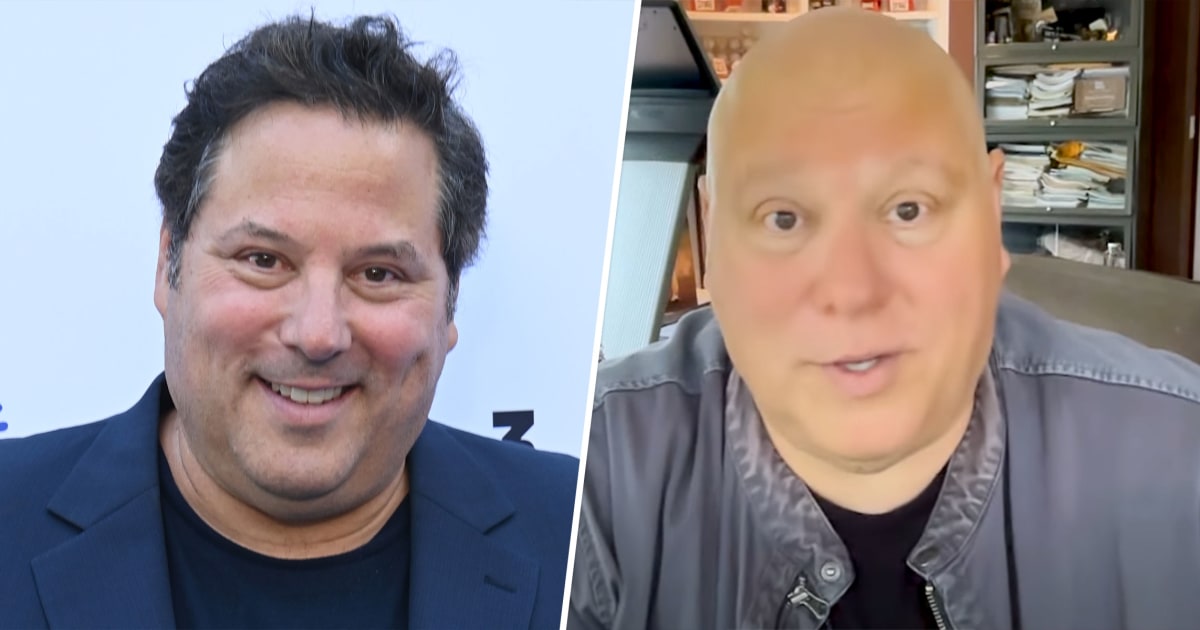 ‘Felicity’ Actor Greg Grunberg Reveals Alopecia Diagnosis