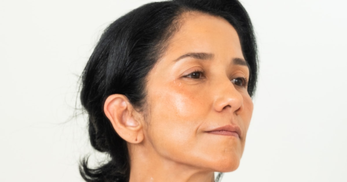 7 Best Retinol Creams Approved by Dermatologists in 2025