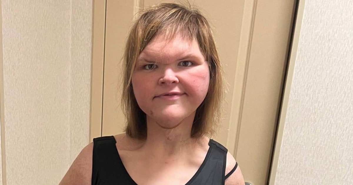 Tammy Slaton Poses in Shapewear After Skin Removal Surgery