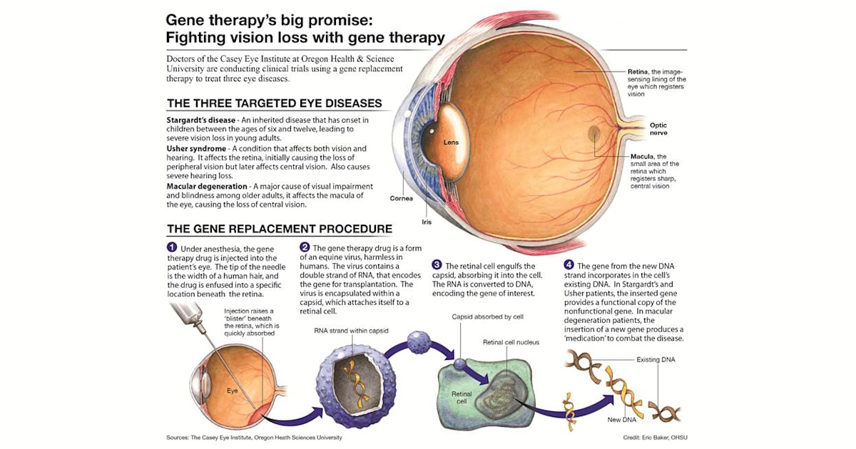 DNA injection to slow vision loss