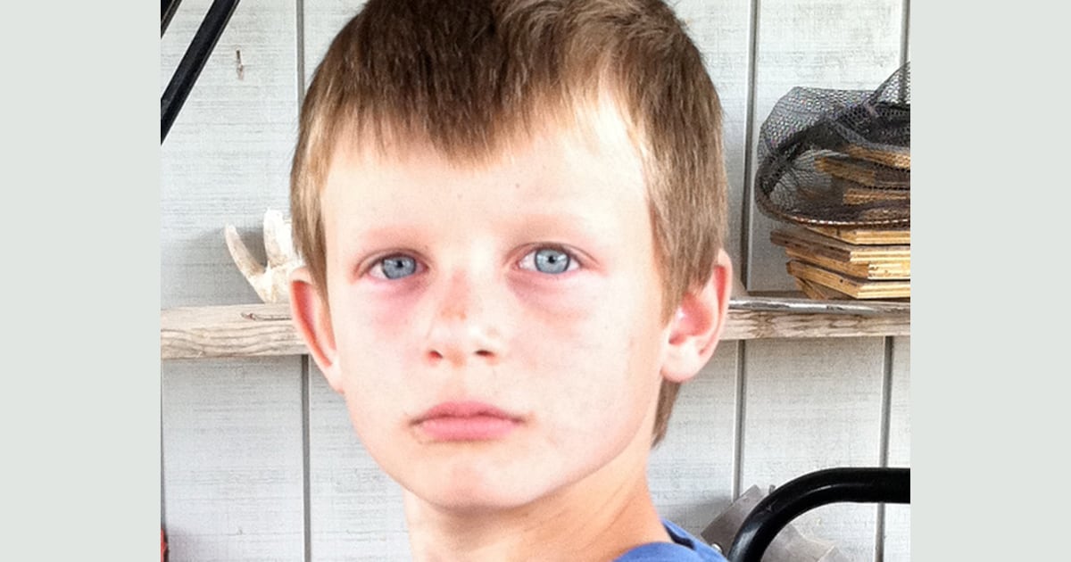 Autistic boy finds voice with Katy Perry's 'Roar'