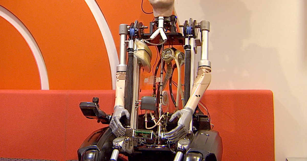 Meet the bionic man: He's 100 percent prosthetic parts
