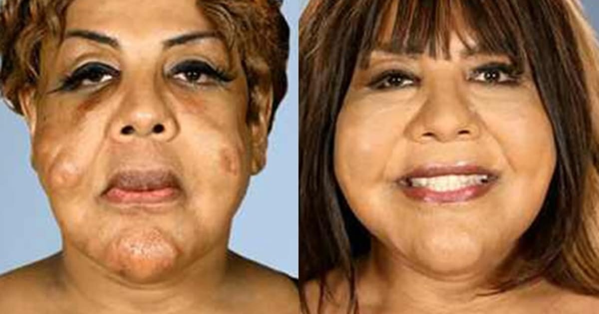 Botched Patients Before and After: Shocking Transformations! - Page 2