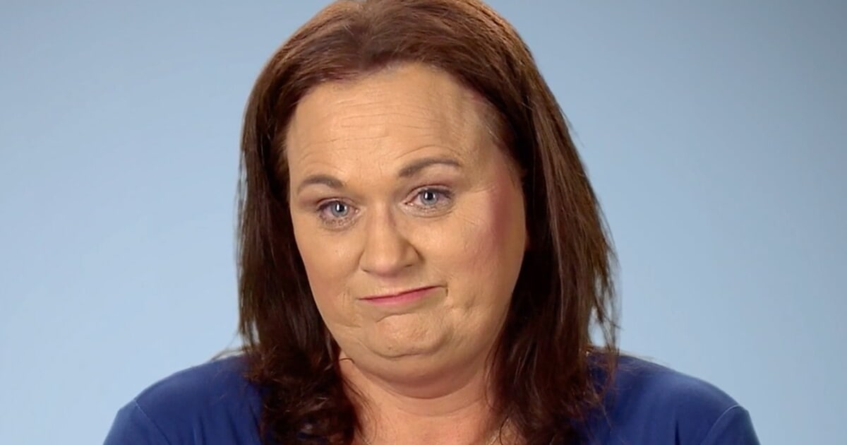Patient With Botched Tummy Tuck Gets Makeover You Won't Believe